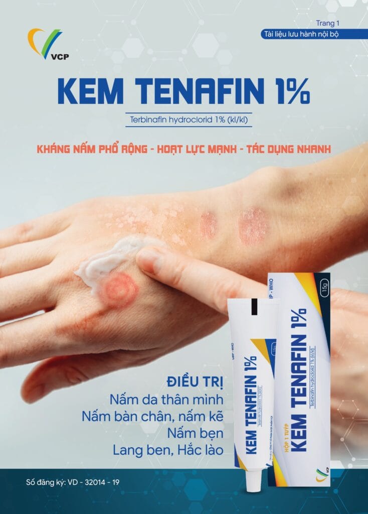Tenafin 1% Cream 15g VCP điều trị nấm bàn chân, nấm bẹn, lác đồng tiền ...